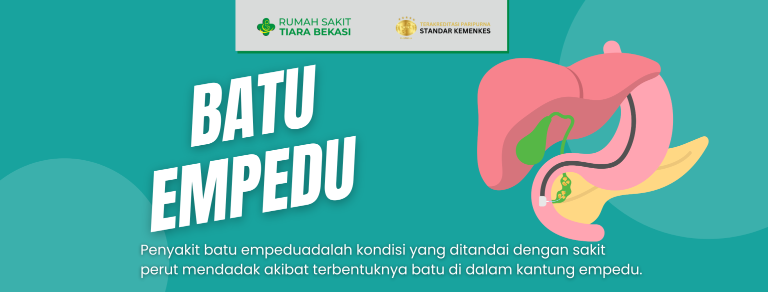 Apa itu Batu Empedu ? Gejala dan Penyebabnya - RS Tiara Bekasi - Rumah ...